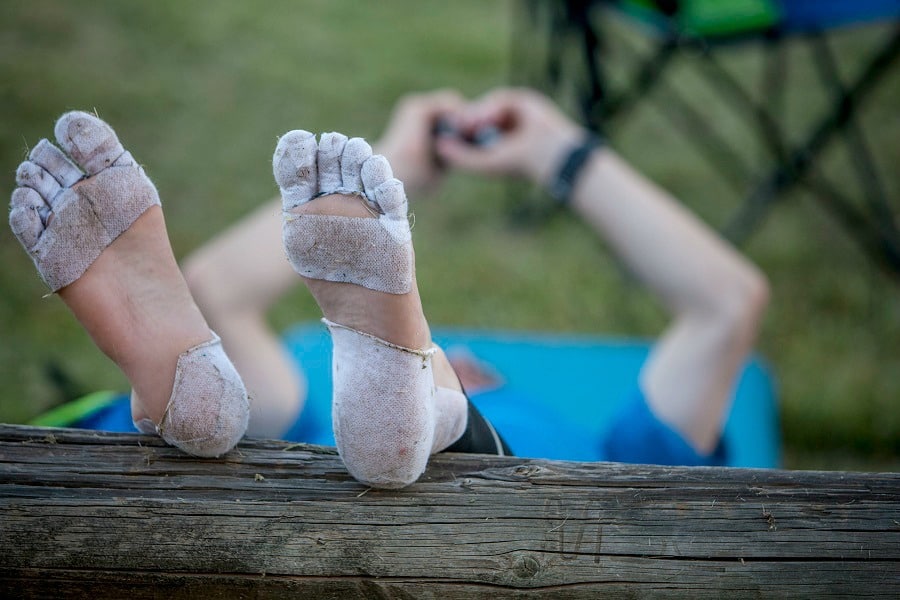 How to Care for A Blister: Don’t Get Them